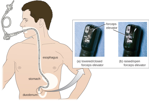 What Conditions Does Motilium Treat?